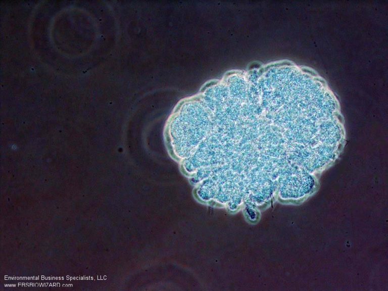 amorphous-zoogloea | EBS
