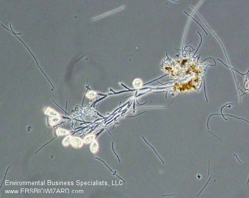 asb_colonial_stalked_ciliates1 | EBS