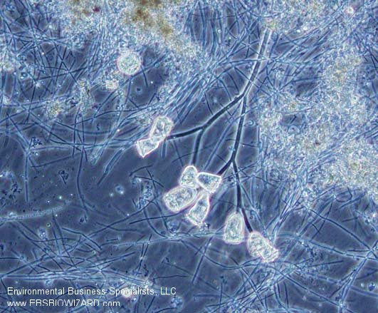 asb_colonial_stalked_ciliates2 | EBS