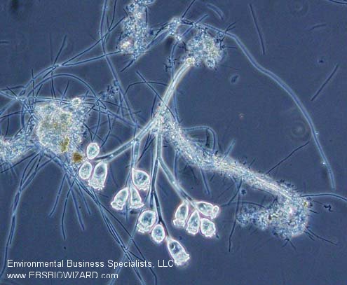 asb_colonial_stalked_ciliates3 | EBS
